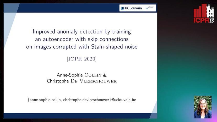Underline Improved Anomaly Detection By Training An Autoencoder With Skip Connections On